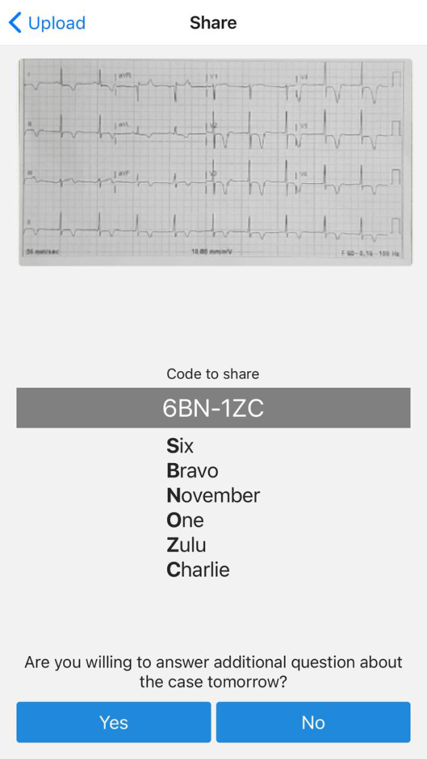 ECG